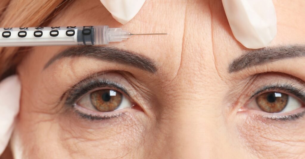 Colocación de Toxina Botulínica | Dr. Aarón Ortega